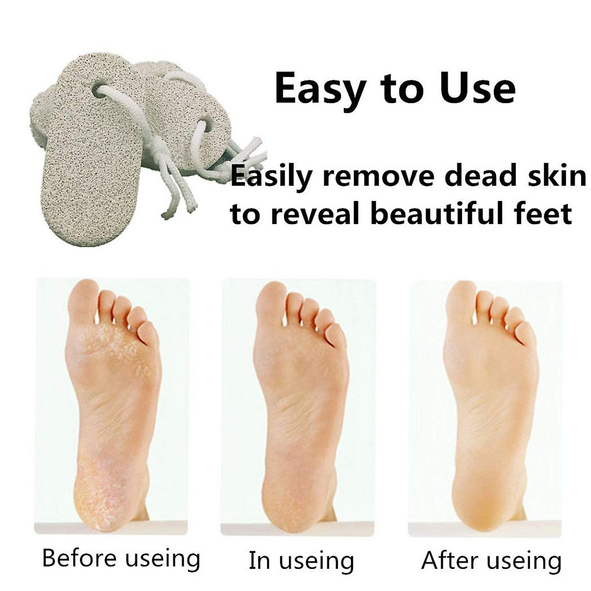 ZHome Natural Pumice Stone for Feet, Phogary Lava Pedicure Tools Hard Skin Callus Remover for Feet and Hands 2PCS