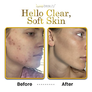 Luxe Beauty: Unscented Luxury Lotion - Anti-Aging Hand & Body Lotion with Hyaluronic Acid - Moisturizing, Lightweight, Non-Greasy Formula for Silky Smooth Skin - Gentle Hand Cream & Body Moisturizer