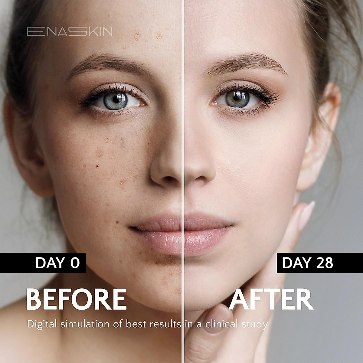 Dark Spot Remover for Face and Body: Dark Spot Corrector for Age Spot Sun Spot Freckles Melasma Brown Spot - Faded Spot Correcting Serum for Face Inner Thighs Hands Intimate Area - 30ML