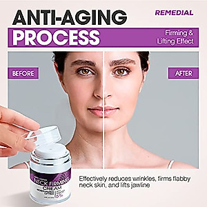 Neck Firming Cream, Anti Aging Facial Moisturizer with Retinol Collagen and Hyaluronic Acid, Day Night Anti Wrinkle Face Cream for Women and Men, Double Chin Reducer, Skin Tightening Lifting Hydrating