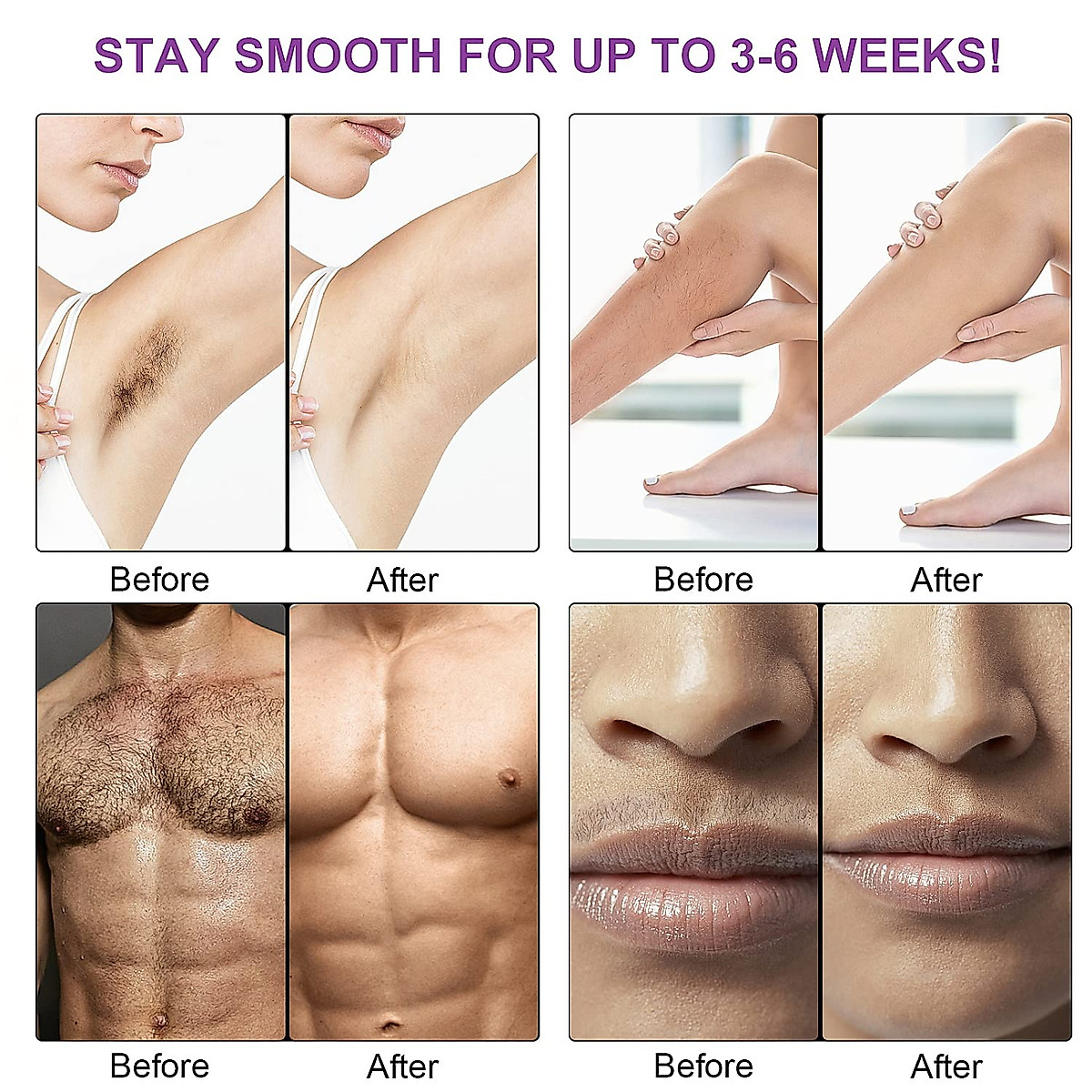 Waxing Kit for Women Men, NYANDU Wax Warmer for Hair Removal, 17.6 oz Wax Beads (5 Packs), Hard Wax Kit for Coarse Hair Facial Eyebrow Legs Armpit Bikini Brazilian, Professional Home Wax Machine