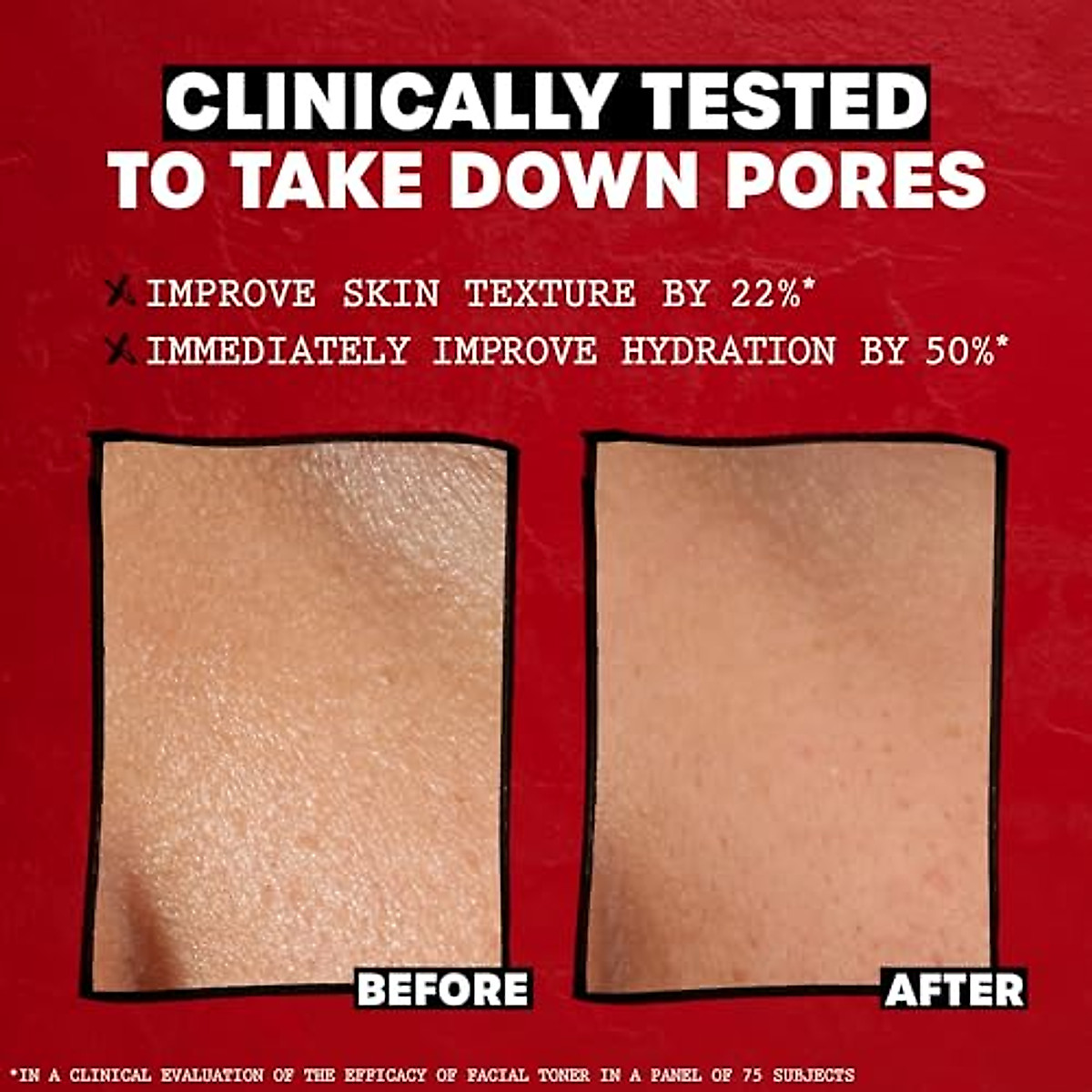 THAYERS Alcohol-Free, Hydrating, Unscented Witch Hazel Facial Toner with Aloe Vera Formula, Vegan, Dermatologist Tested and Recommended, 12 Oz (Packaging May Vary)