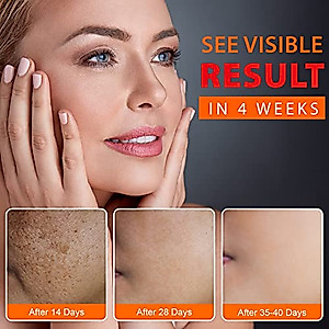 Dark Spot Corrector, Large 65 ML Dark Spot Remover for Face and body, Dark Spot Serum, Ideal for Fine Lines, Uneven Skin Tone, Nutrient Rich Formula with Squalene, Deep Hydration Cream