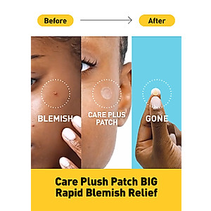 OLIVE YOUNG Care Plus Honey Scar Cover Korean Spot Pimple Patches 1Pack(84 Count) - Hydrocolloid Patch, Spot Stickers for Acne Pimple Blemishes and Zits, Contains Manuka Honey(10mm*60ea + 12mm*24ea)