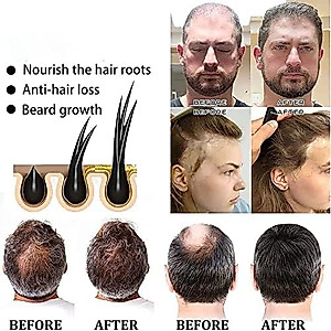 MIXAROLA Black & Thick Hair Fallopia Multiflora Shampoo Bar, He Shou Wu Extract Shampoo Soap, Deeply Cleanses and Promotes Hair Growth, Prevents Hair Loss and Scalp. (3pcs)