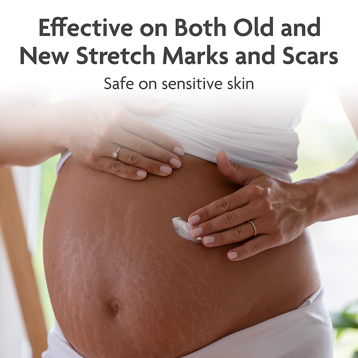 TriLASTIN SR Vit. Infused Intensive Stretch Mark & Scar Cream for Pregnancy - 5.5 Oz, Cocoa Butter Scar Treatment, Hypoallergenic & Paraben-Free - Moisturizing Lotion for Women