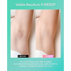 INNZA IPL Hair Removal Device for Women and Men at Home,Permanent Hair Remover Machine with 1 Attachment,10 Energy Levels,24J High Energy Hair Removal Handset for Face Bikini Line Armpit Back,Corded