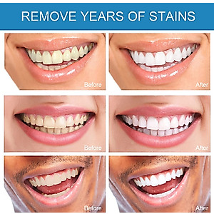 Teeth Whitening Pen, Instant Teeth Whitener, Effective Teeth Whitening Gel, Painless for Tooth Whitening, Perfect Sensitive Teeth Whitening Product, Travel Friendly, Natural Mint Ingredient- 2Pcs