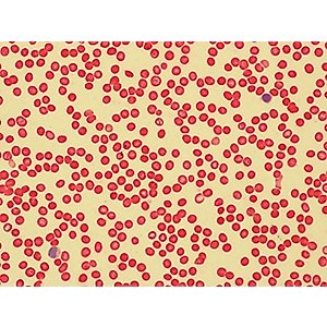 Prepared Slide, Human Blood with Wrights Stain, Classpack of 15 Sides
