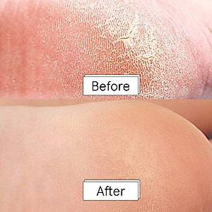 Grace & Stella Under Eye Mask (24 pairs, Blue) + Foot Peel Mask (4 Pairs, Unscented)