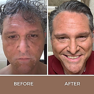 Vitiligo Vanquish Cosmetic Camouflage Kit by Fake Bake Liquid Concealer, Long Lasting Natural Color Customization Eliminates Appearance of Skin Depigmentation For Women & Men - Cover Lasts For Days