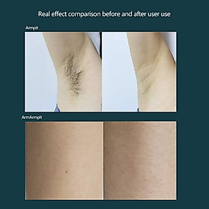 Hair Removal Machine, 808 Semi-Conductor Laser Hair Removal Machine Mini Portable Ice Compress Depilation Instrument(US)