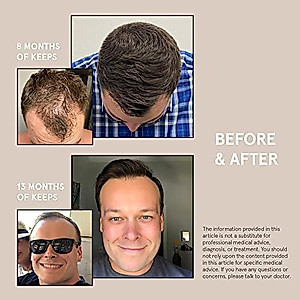 Keeps Minoxidil for Men Topical Hair Loss Aerosol Minoxidil Foam 5%, Hair Growth Treatment - Slows Hair Loss & Promotes Hair Regrowth - 3 Month Supply (3 x 2.11oz Bottles) - For Thicker, Longer Hair