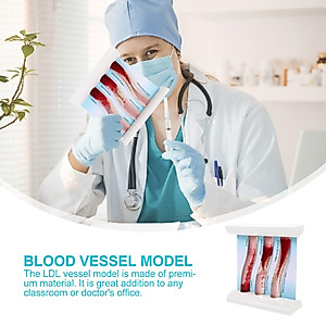 Human Body Skeleton Anatomical Model Low- Density Lipoprotein Blood Vessel Model