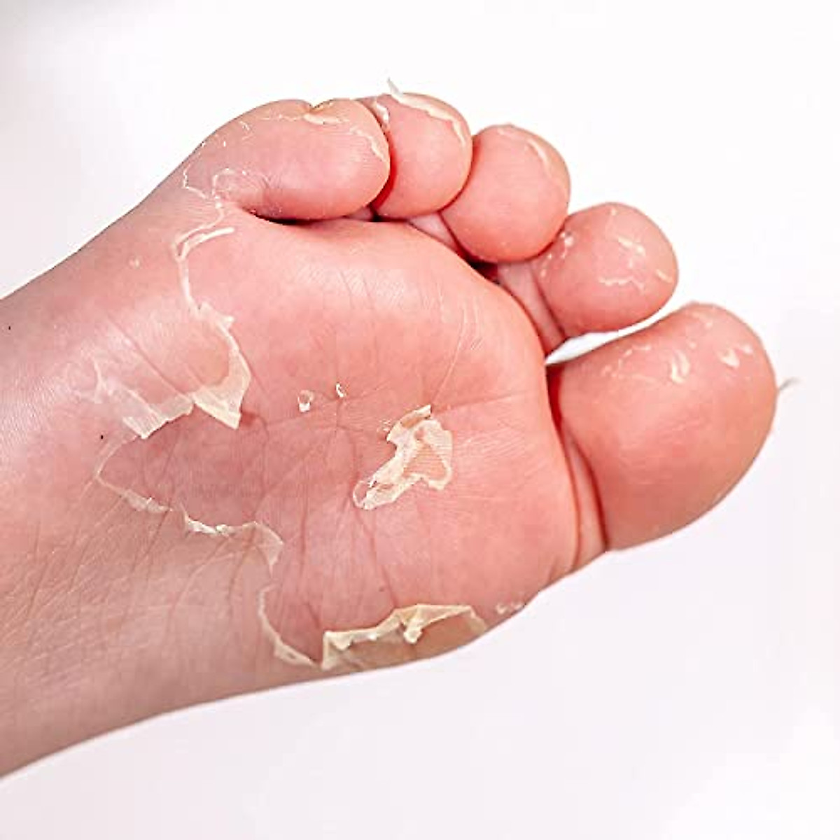 Onyx Professional Foot Peel Mask Callus Remover (2 Pack) Dead Skin Remover, Foot Exfoliator, Cracked Heel Repair - Feet Peeling Mask Pedicure Kit For Smooth Baby Soft Healthy Feet