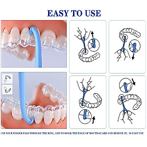 Dentosmile Aligner Remover Tool/Invisible Removable Braces, Invisible Aligner Remover-Aligner Remover-Fixer (White) (Pack of 10)