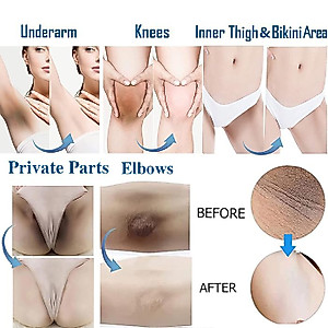 Skin Lightening Cream Serum Skin Bleaching Cream Whitening Cream For Body Intimate Area, Private Parts, Underarm, Knees, Elbows, Inner Thigh, Bikini Areas, Bikini Line.