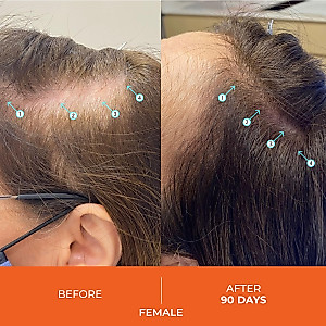 DS Laboratories Revita Shampoo and Conditioner Set - Hair Growth Shampoo and Conditioner, Hair Thickening Shampoo and Conditioner for Fine Hair, DHT Blocker Hair Loss Treatments for Women & Men