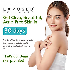 Exposed Skin Care Body Wash - Back and Body Acne Wash with Salicylic Acid and Tea Tree Oil – Exfoliating Bacne Treatment for Clearer, Healthier Skin – Body Cleanser for All Skin Types (12 fl oz)