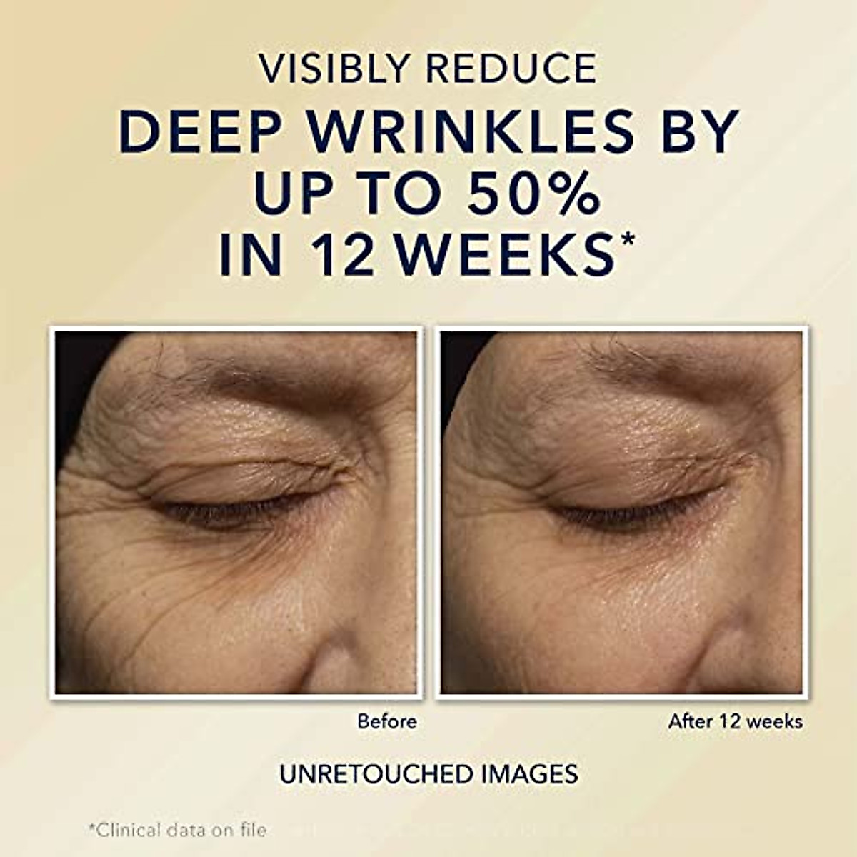 RoC Retinol Correxion Deep Wrinkle Anti-Aging Night Cream, Daily Face Moisturizer with Shea Butter, Glycolic Acid and Squalane, Skin Care Treatment, 1 Ounce