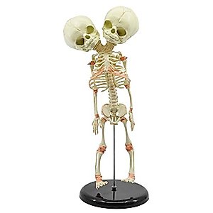 Infant Fetus Skeleton Model, Mini Size - Twin, Conjoined Skull - Rod Mounted - Incredible Detail for Anatomical Study - Eisco Labs