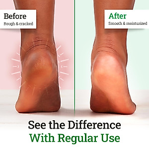 Truremedy Naturals - Remedy Balm with Tea Tree Oil - Soothing Itch Relief Ointment for Rash & Itchy Skin - Moisturizing Cream for Dry Skin - 100% Natural Foot & Body Balm - Lavender & Eucalyptus, 2oz