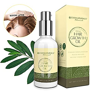 EssyNaturals Hair Growth Oil with Caffeine and Biotin - For Stronger, Thicker, Longer Hair, 1.7 oz (1 Pack)