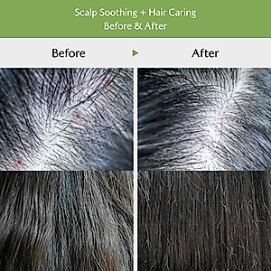 LA'DOR Hair Conditioner - Tea Tree Scalp Clinic Hair Pack, 6.76 Fl Oz - Calming & Nourishing with Snail Mucin, Green Tea, Aloe for Itchy Sensitive Dry Flaky Damaged Scalp