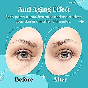 Hydra Blue Collagen Under Eye Gel Mask - Bright Eyes Anti Aging Treatment For Dark Circles, Puffy Eyes, Bags, Fine Lines - 30 Pairs (60 Total Patches)