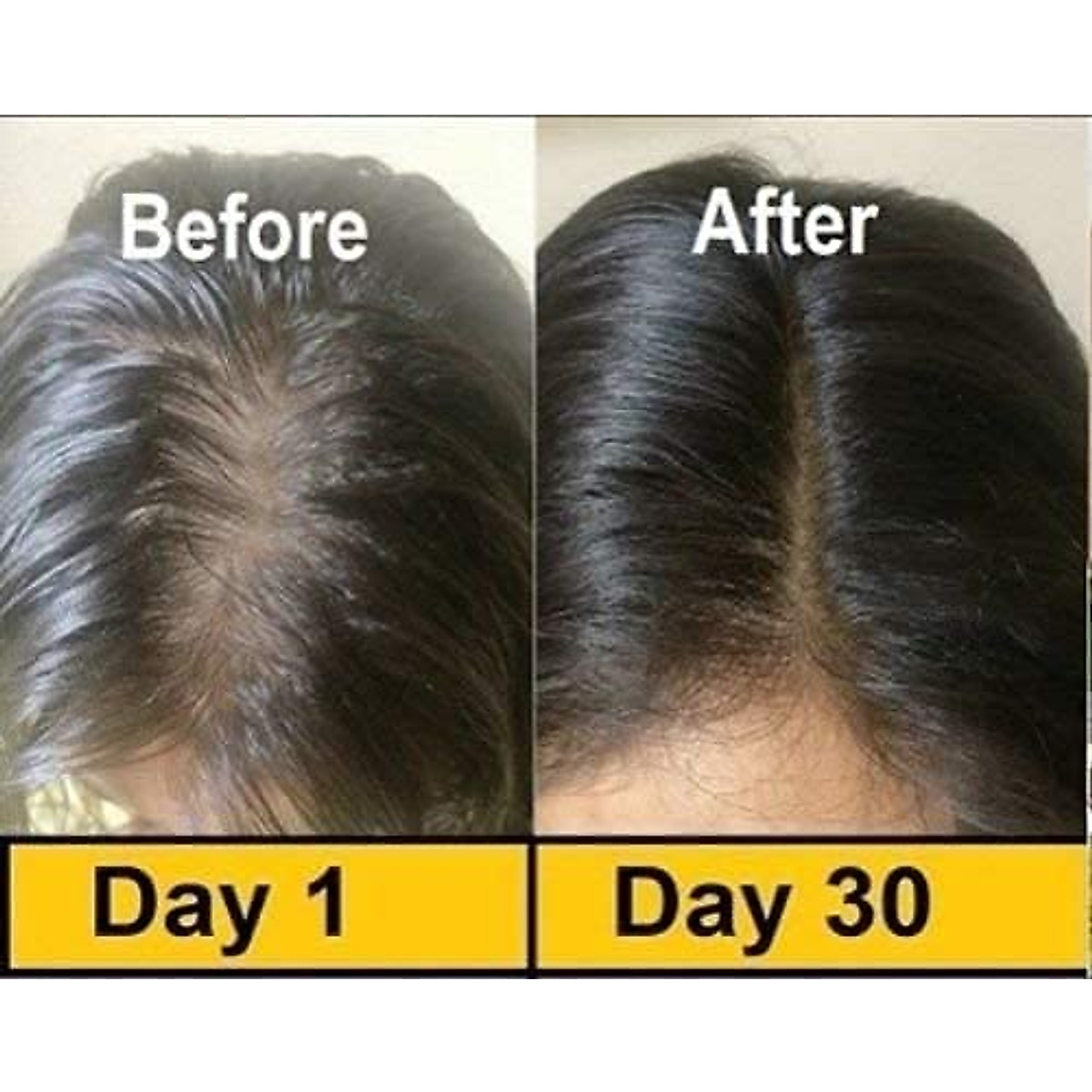 Merck Ltd. 50 Evion Capsules Vitamin E For Glowing Face,Strong Hair,Acne,Nails, Glowing Skin 400mg