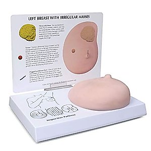 GPI Anatomicals - Human Anatomy Model of Left Breast with Irregular Masses, Replica for Anatomy and Physiology Education, Anatomy Model for Doctor's Office and Classrooms, Medical Study Supplies