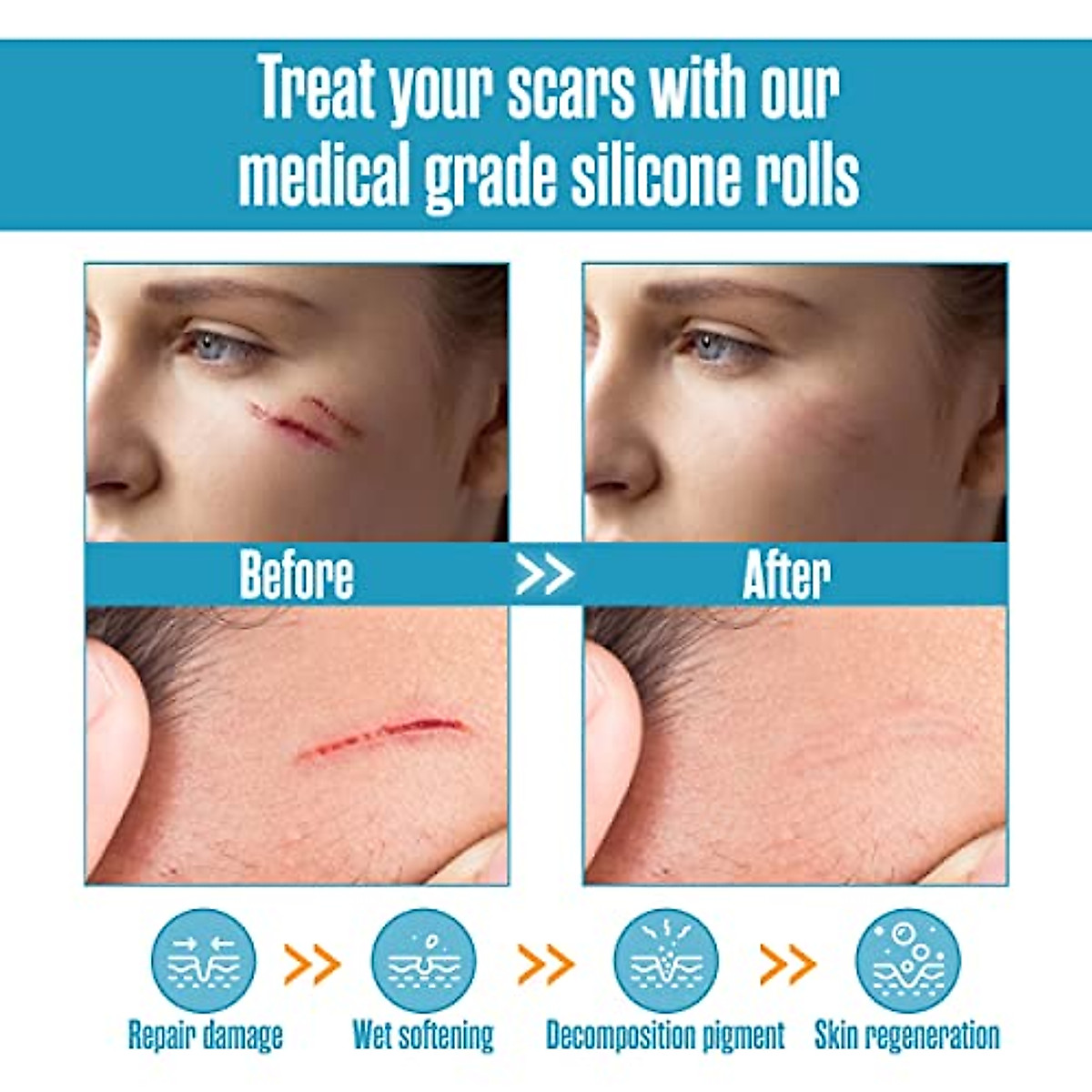 Silicone Scar Sheets, Soft Gel Tape, 1.57” x 60”, with 2” Perforations, Tan, Flexible, Medical Grade for Surgery, Keloids, Burns, Sensitive Skin, Wound Protection, Healing Patch | Houseables