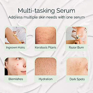 Serious Serum Ingrown Hair Treatment – Glycolic, Lactic & Salicylic Acid Exfoliating Serum for Face & Body, Soothes Razor Bumps, Prevents Ingrown Hairs, Hydrating Formula for Post-Shave & Waxing Care