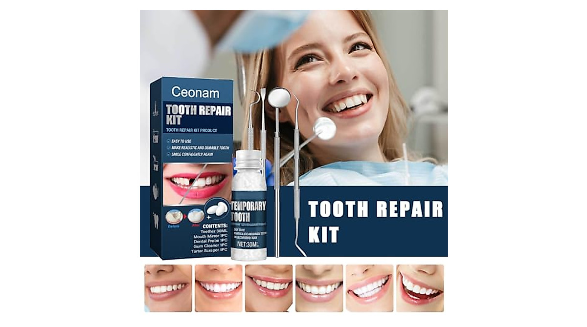 Tooth Repair Kit – Quick & Easy Dental Solution