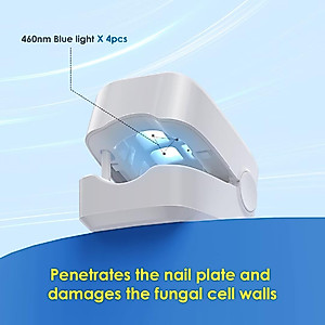 Nail Fungus Cleaning Light Device, FSA or HSA eligible Nail Fungus for Damaged Discolored Thick Toenails & Fingernails, Effective Rechargeable Nail Fungus Remover for Home Use
