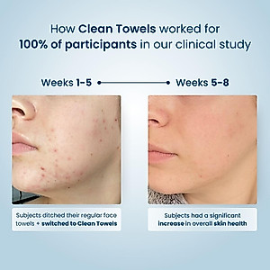 Clean Skin Club Clean Towels XL™, 100% USDA Biobased Face Towel, Disposable Face Towelette, Eczema Association Accepted, Makeup Remover Dry Wipes, Ultra Soft, 100 Ct, 2 Pack