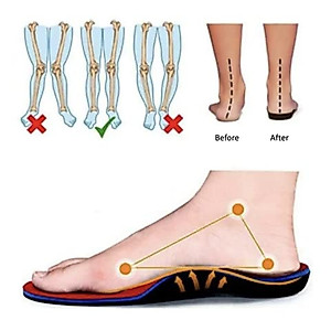 DASSIO Women's Orthopedic Sneakers, Ladies Rocker Shoes Air Cushion Platform Orthopedic Slip-On Walking Shoes with Arch Support, Mesh Tennis Sports Shoes Lightweight Sneaker (Black,37)