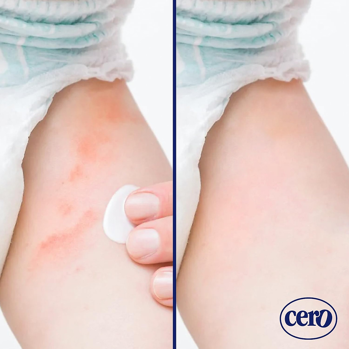 Crema Cero Diaper Rash Cream for Baby With Zinc Oxide – High-Strength Diaper Cream for Quick Relief and Protection – Hydrating and Soothing Baby Balm – 3.9oz