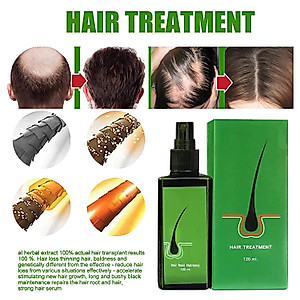 Hair Growth Serum for Men and Women - Natural Nourishing Scalp Spray for Hair Lotion, Hair Root, Thinning Hair, and Hair Loss (120ml)