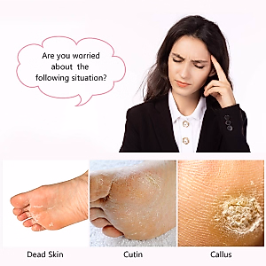 Fangze Pumice Stone Brush for Feet - 2 Pack Foot Brush Scrubber 4 in 1 Foot File Pedicure Paddle Kit for Foot Care (Lilac and Blue)