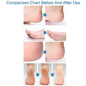 Panasonic ER240B Beard & Mustache Trimmer for Men