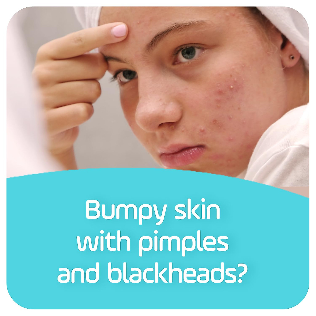 Asepxia Cleansing Bar Scrub, 4 Ounce Multipack (Pack of 5)