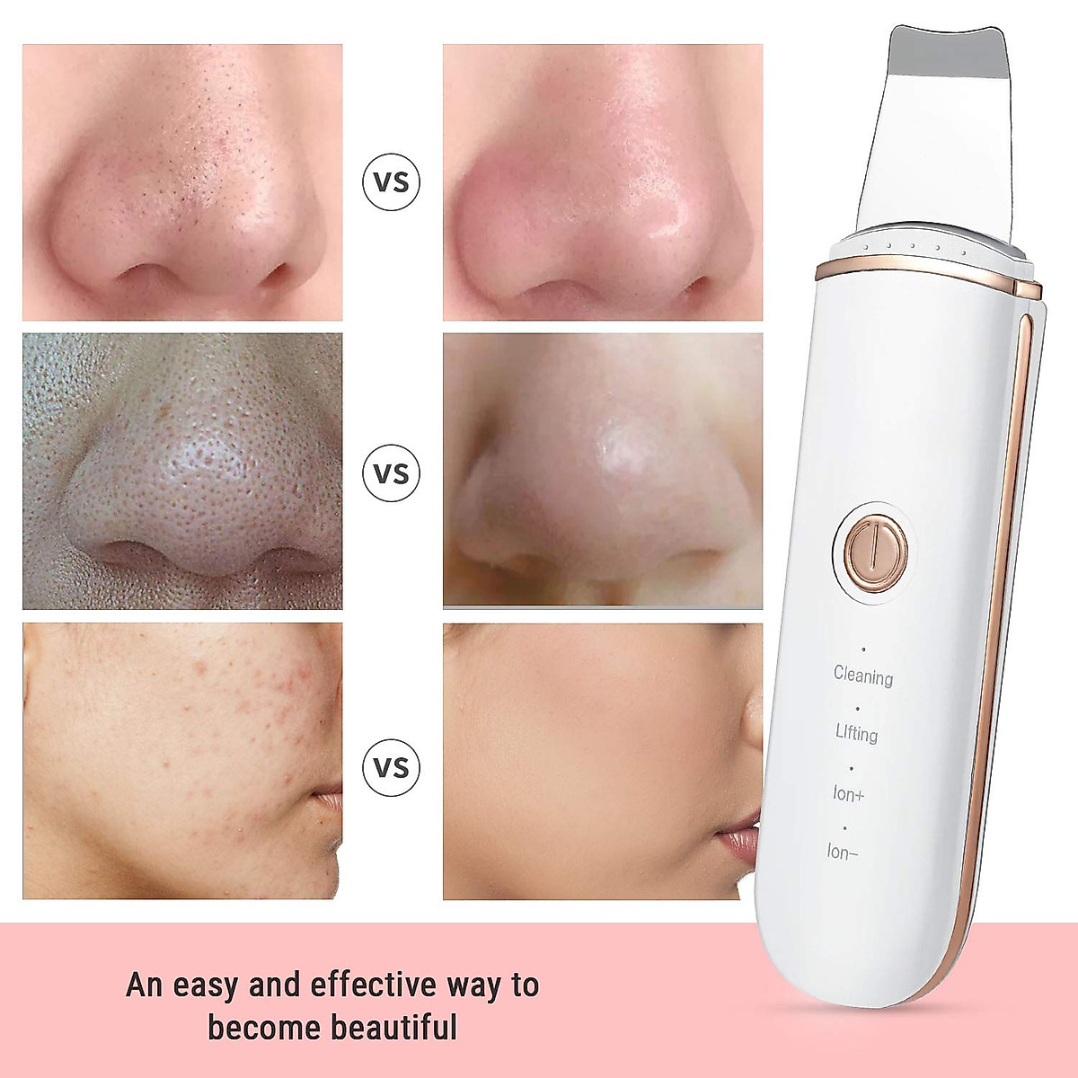 Skin Scrubber, Skin Spatula, Pores Cleanser Exfoliator Blackhead Remover Comedones Extractor for Facial Deep Cleansing with 4 Modes Include 4 Pcs Acne Reml Tool