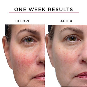 Hey Honey Skincare Good Morning Honey Silk Facial Serum for True Glow | Vitamin C Fast Acting Skin Hydrator and Skin Barrier Protector | with Hyaluronic Acid Serum | 1 oz