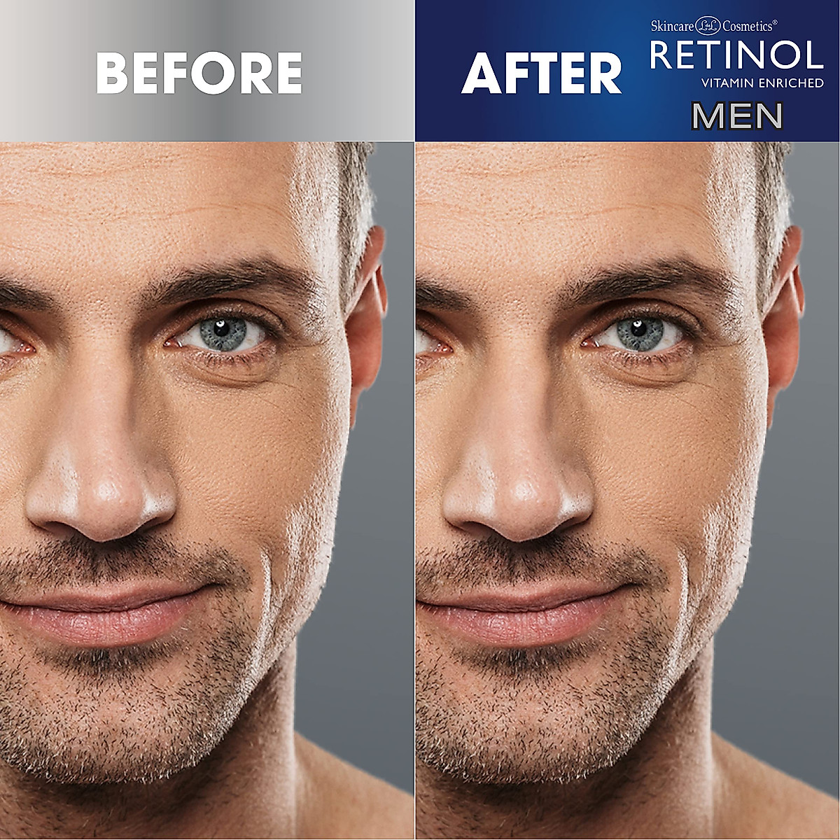 Retinol Men’s Anti-Wrinkle Facial Serum – The Original Retinol Anti-Aging Men’s Formula For Younger Looking Skin – Vitamin-Enriched To Smooth Fine Lines & Wrinkles, Improve Tone & Promote Firmness