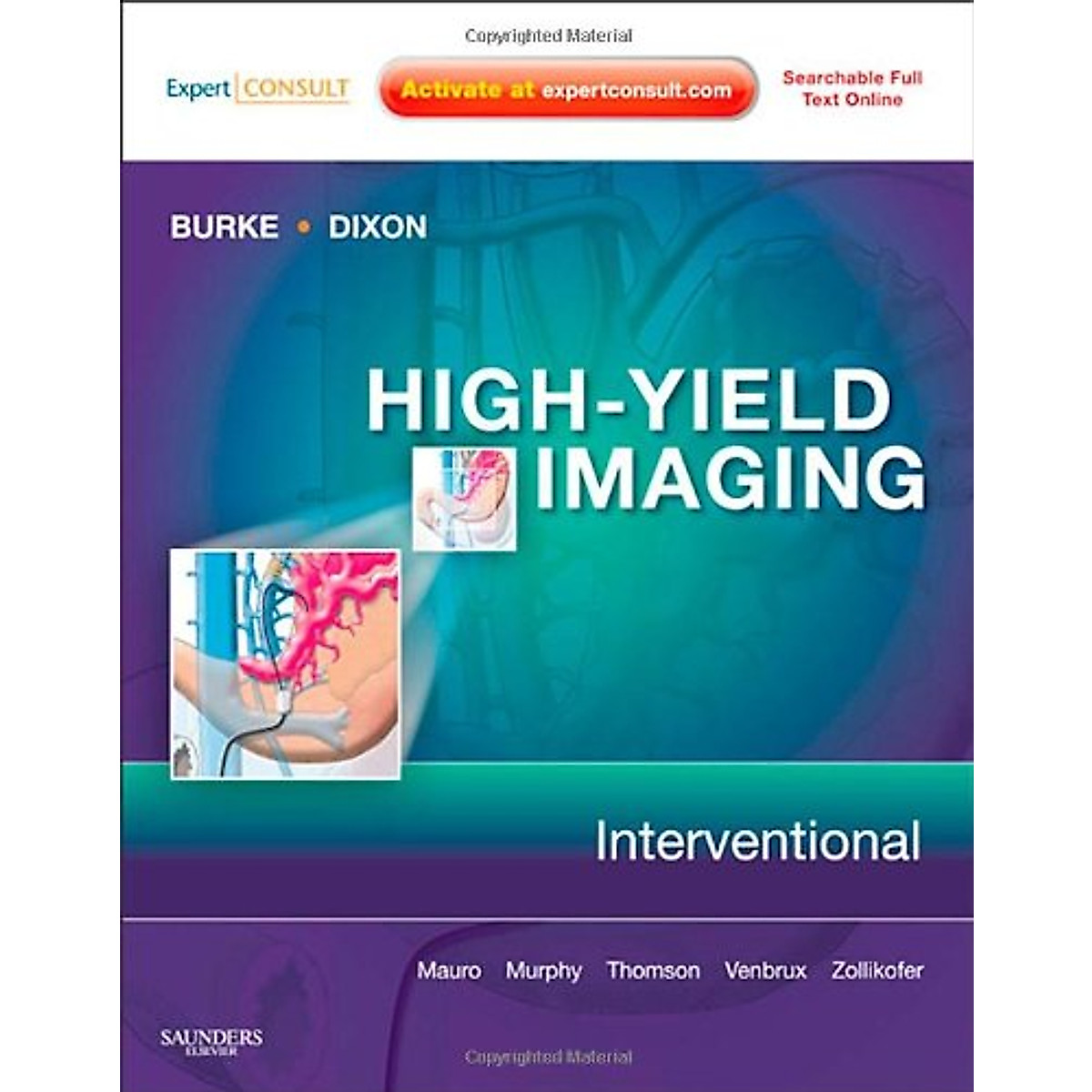 High-Yield Imaging: Interventional: Expert Consult - Online and Print (High Yield in Radiology)