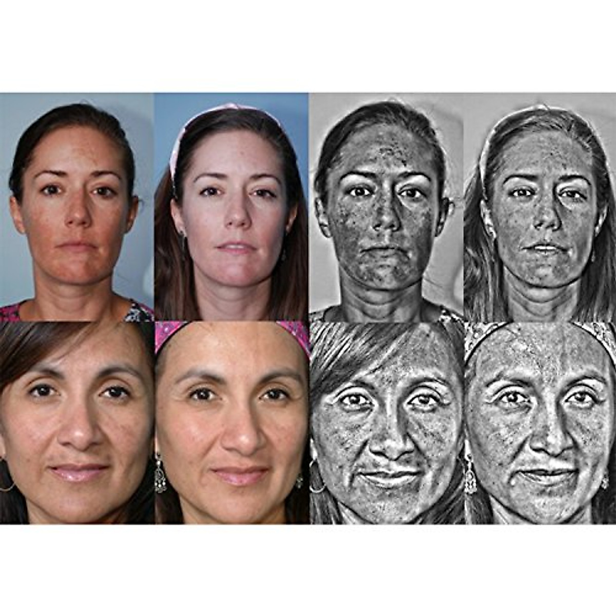 dEpPatch DARK SPOT Correcting Cream with ANTI AGING Peptides for Face and Body | Tighten, Maintain Even Radiant Skin Tone| All Natural Active Ingredients, Made in the USA (1 fl oz)