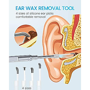 Teslong Otoscope Set with Disposable Covers, Ear Pick, 4.3mm HD Inspection Camera, 6 Adjustable LED Lights with Ear Wax Removal Tools, Works with iPhone, iPad & Android