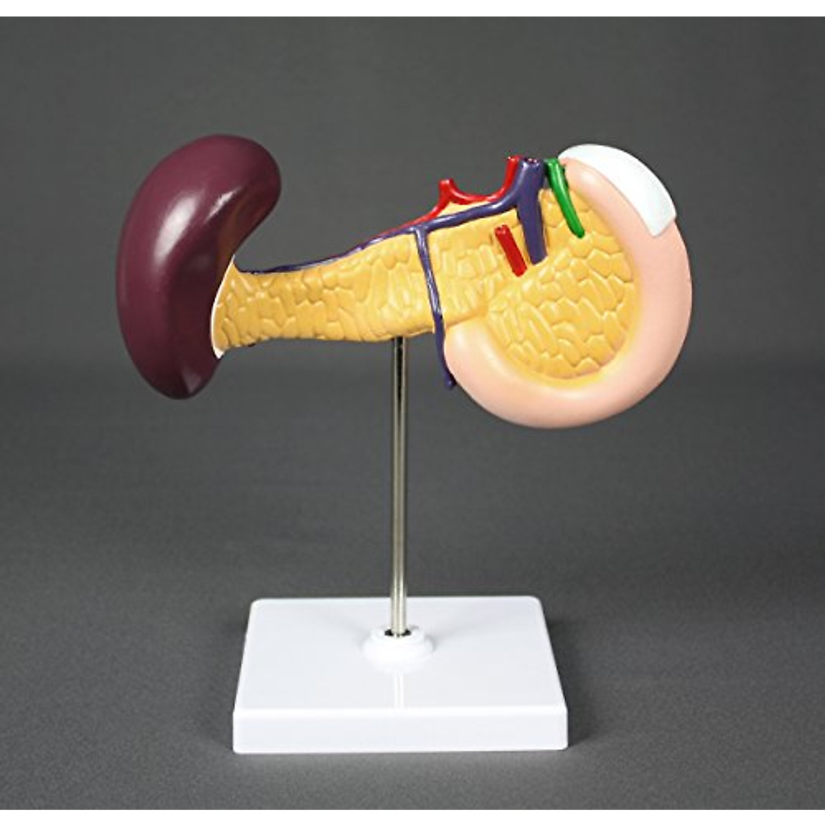 Vision Scientific VAD423-N Pancreas, Duodenum, & Spleen Model