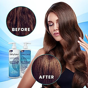 Biotin Hair Growth Shampoo And Conditioner For Women And Men With DHT Blockers, Shampoo and Conditioner For Thinning Hair and Hair Loss, Paraben Free, Sulfate Free, 16 oz. (473 ml) Bottles